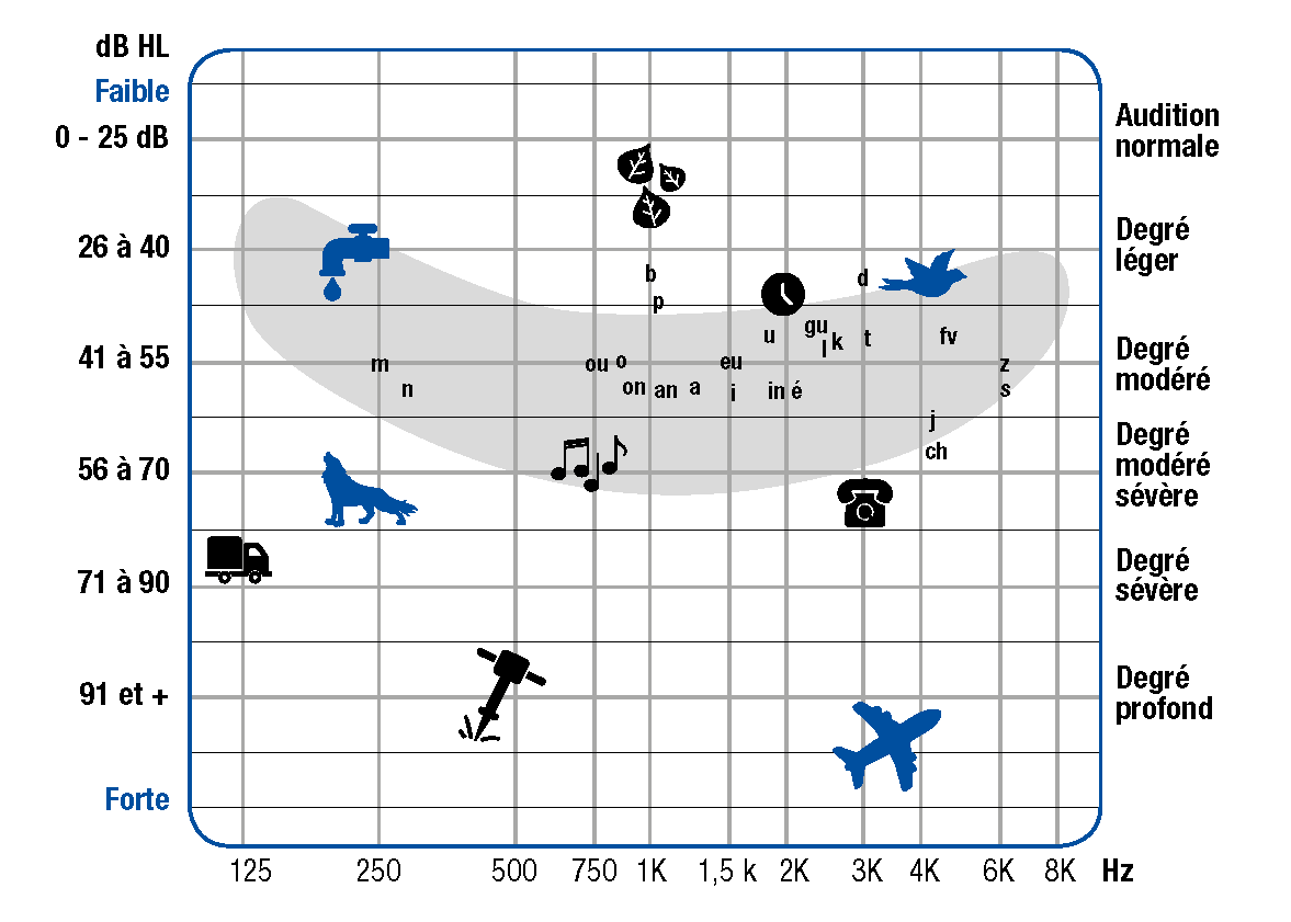 Comment interpréter l'audiogramme? - Audition Québec